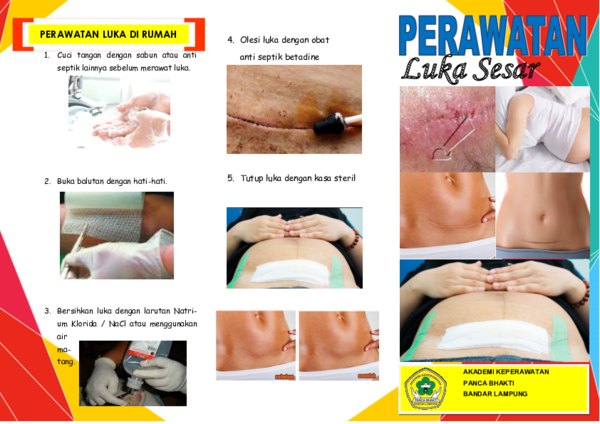 (PDF) 1. LEAFLET PERAWATAN LUKA SESAR (A4 Bolak balik).pdf