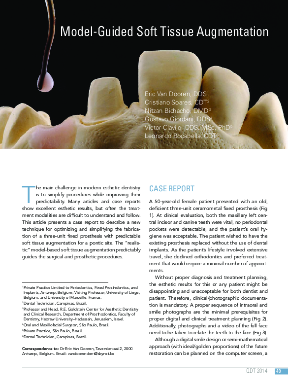 (PDF) Model-guided soft tissue augmentation.