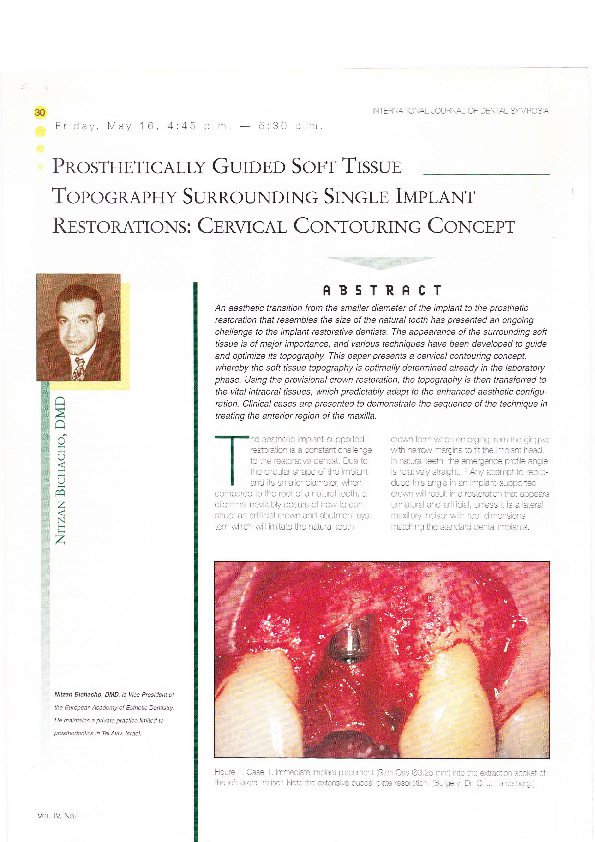 (PDF) Prosthetically guided soft tissue topography surrounding single ...