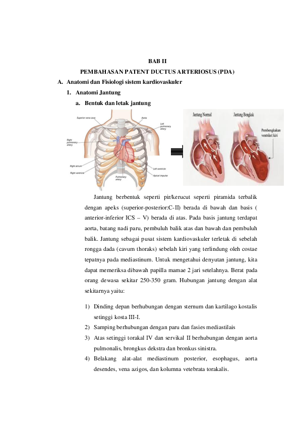 (DOC) BAB II kep anak