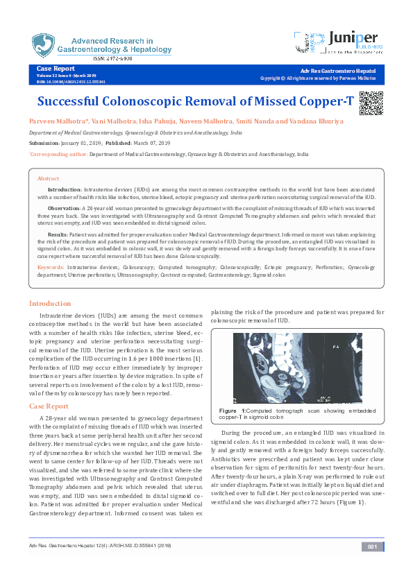 (PDF) Colonoscopic Removal of Copper-T