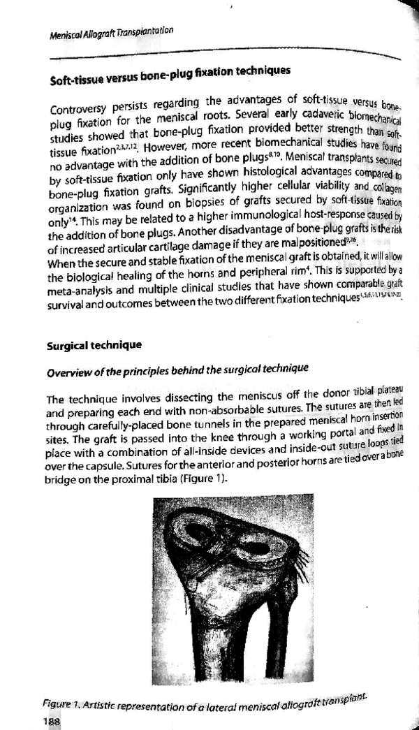 (PDF) Meniscus allograft transplantation