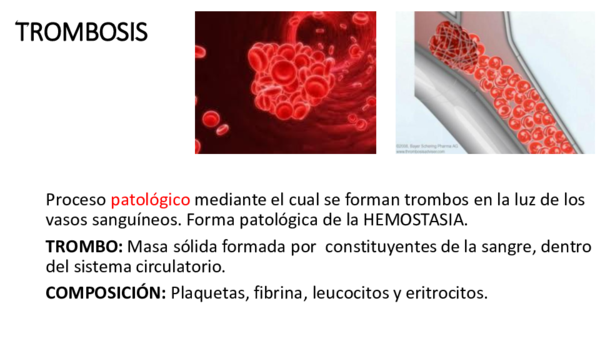 (PDF) TROMBOS Y EMBOLOS