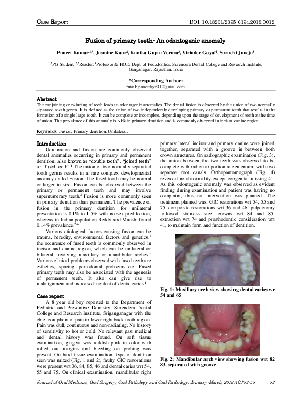 (PDF) Fusion of primary teeth- An odontogenic anomaly
