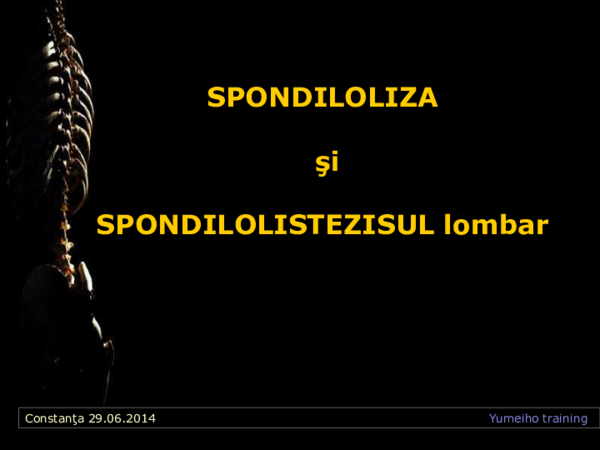 (PDF) SPONDILOLIZA şi SPONDILOLISTEZISUL lombar