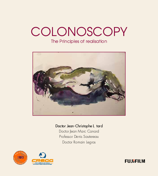 (PDF) COLONOSCOPY The Principles of realisation