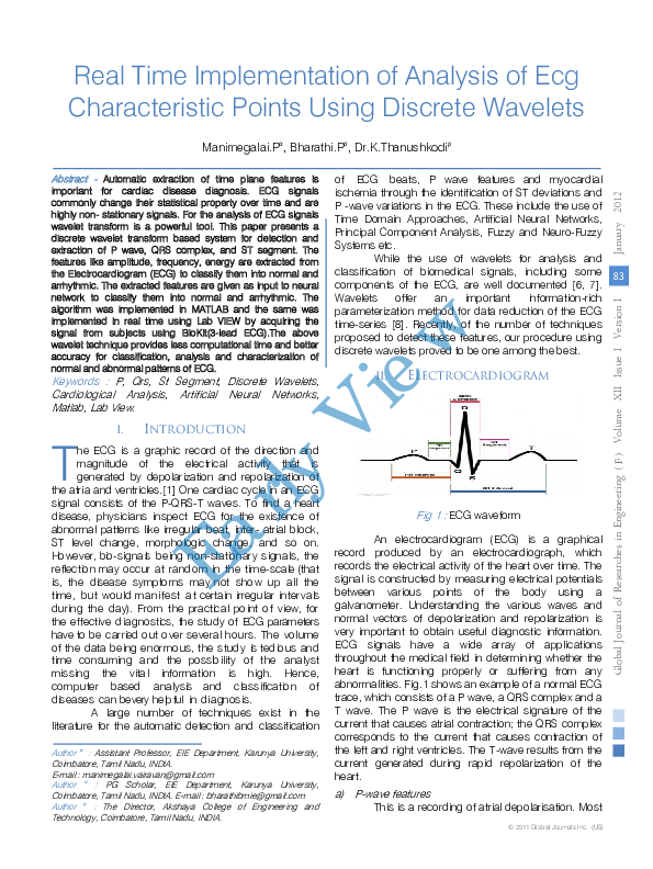 (PDF) Real Time Implementation of Analysis of Ecg Characteristic Points Using Discrete Wavelets