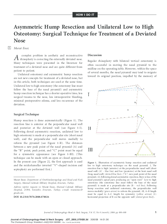 (PDF) Asymmetric hump resection and unilateral low to high osteotomy