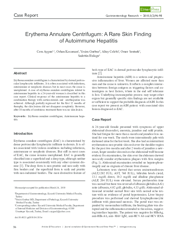 (PDF) Erythema Annulare Centrifugum: A Rare Skin Finding of Autoimmune ...