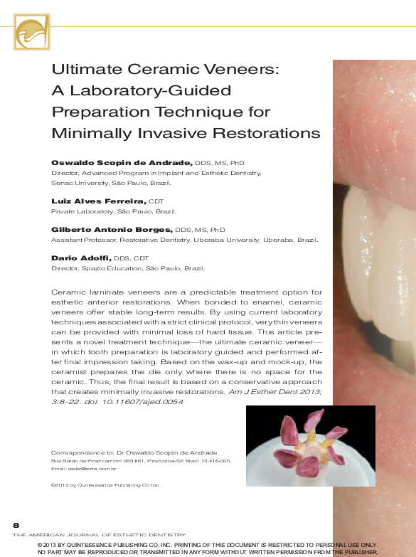 (PDF) Ultimate Ceramic Veneers: A Laboratory-Guided Preparation ...