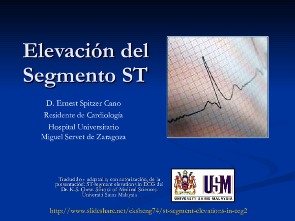 (PDF) Elevación del Elevación del Segmento ST Segmento ST Traducido y adaptado, con autorización ...