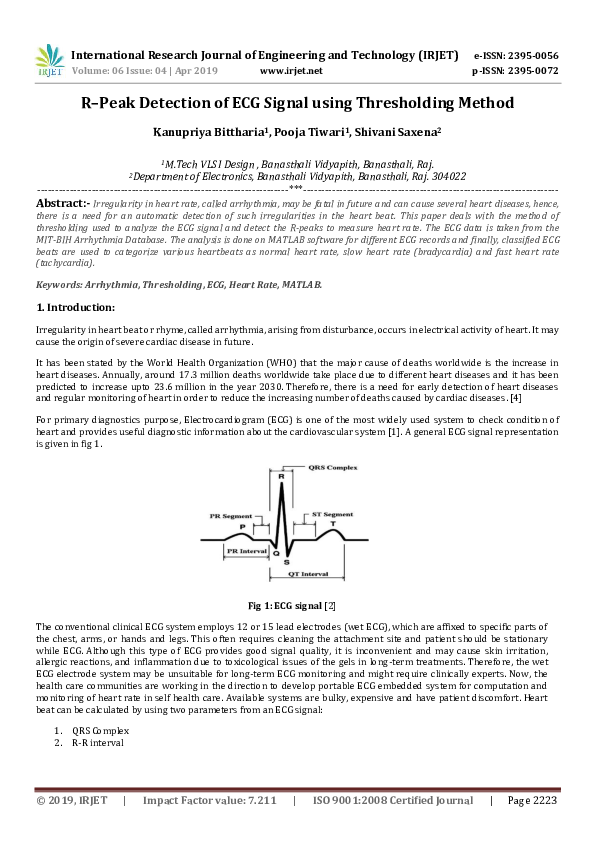 (PDF) IRJET- R-Peak Detection of ECG Signal using Thresholding Method