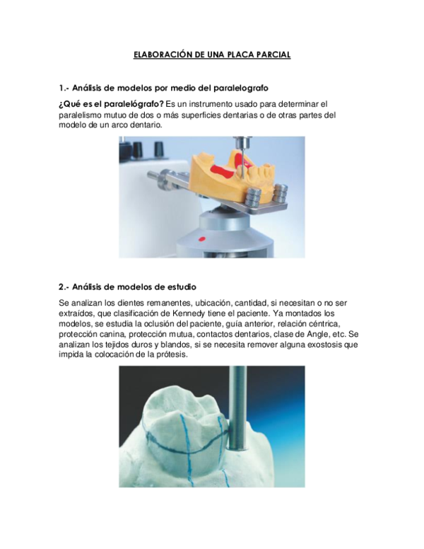 (DOC) ELABORACIÓN DE UNA PLACA PARCIAL