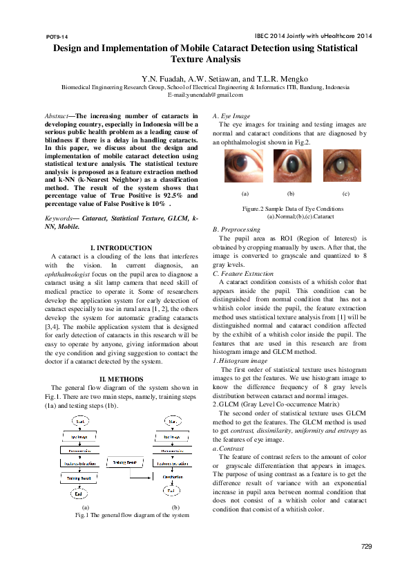 Pdf Design And Implementation Of Mobile Cataract Detection Using