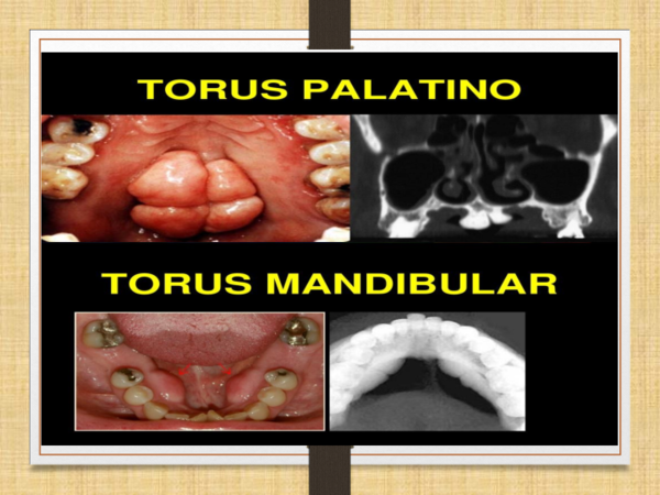(PPT) Torus palatino