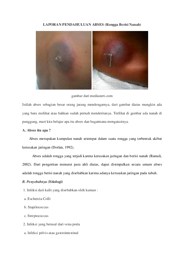(DOC) Asuhan Abses Fix
