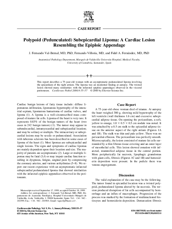 (PDF) Polypoid (Pedunculated) Subepicardial Lipoma