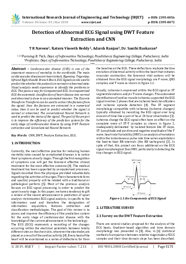 Pdf Irjet Detection Of Abnormal Ecg Signal Using Dwt Feature