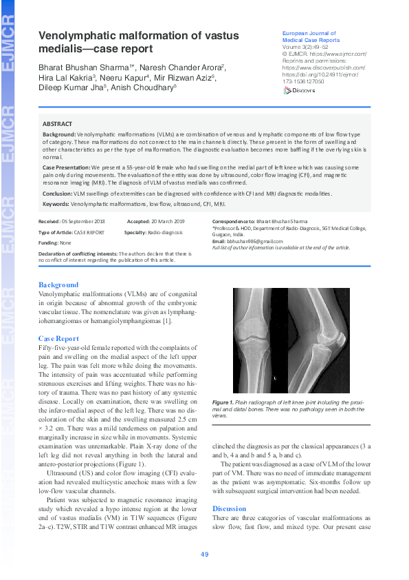 (PDF) Venolymphatic malformation of vastus medialis-case report