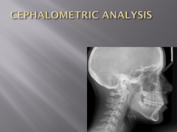 (PPT) W-cephalometric | Syeda Amatur Rehman Salman - Academia.edu