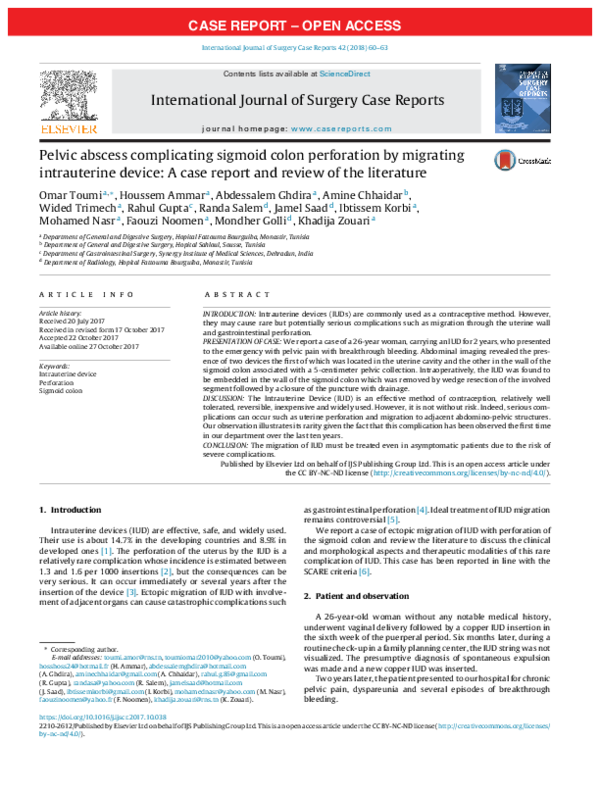 Pdf Pelvic Abscess Complicating Sigmoid Colon Perforation By Migrating Intrauterine Device A