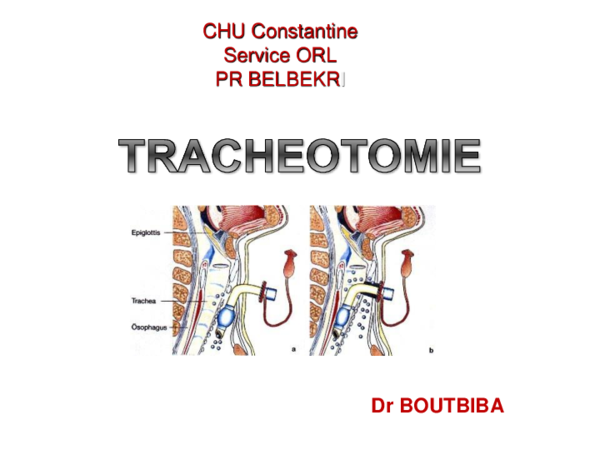 (PPT) Trachotomie bout