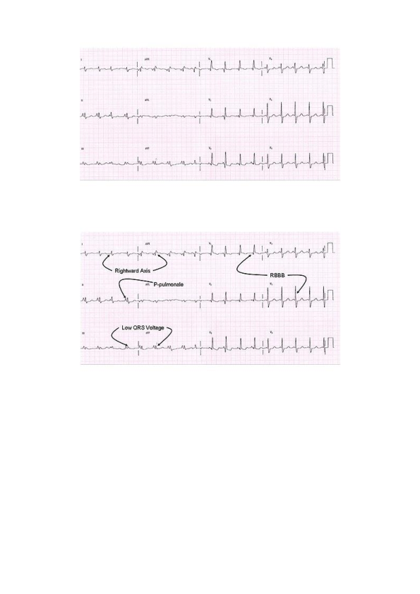 (DOC) ECG case