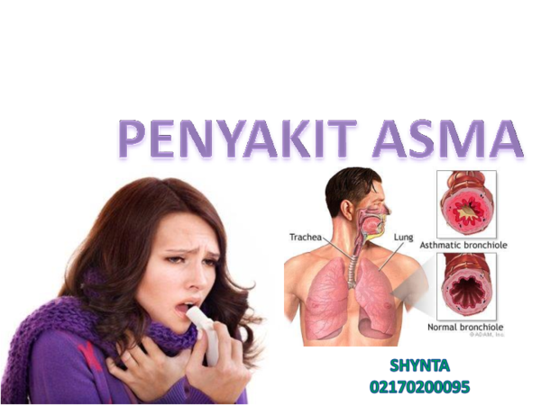 (PPT) PPT ASMA edukasi