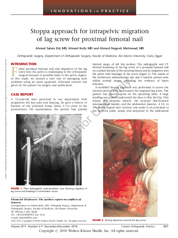 (PDF) Stoppa approach for intrapelvic migration of lag screw for ...