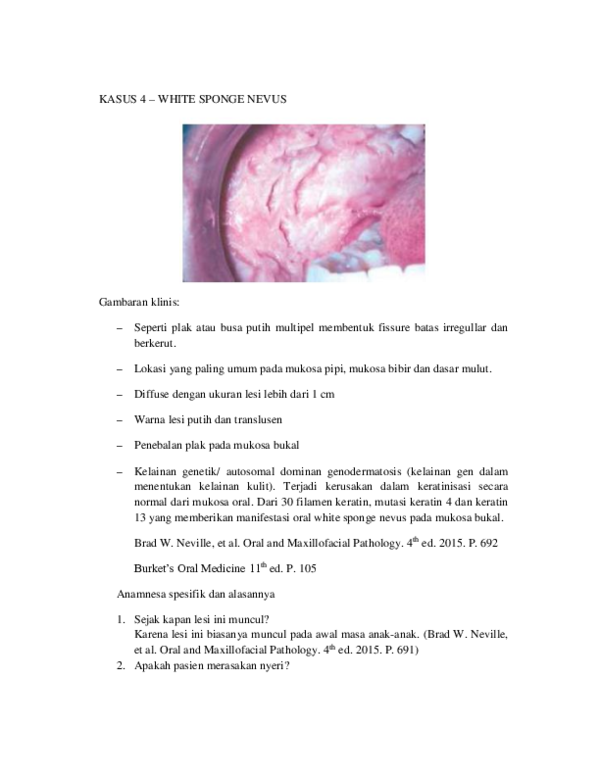 (DOC) KASUS 4 -WHITE SPONGE NEVUS
