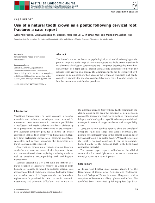 (PDF) Use of a natural tooth crown as a pontic following cervical root ...