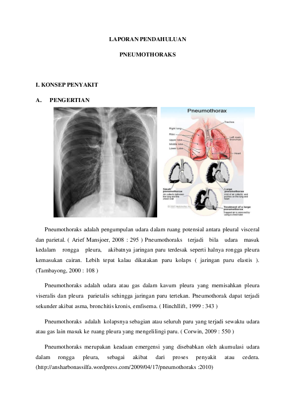 (DOC) Pneumothorax