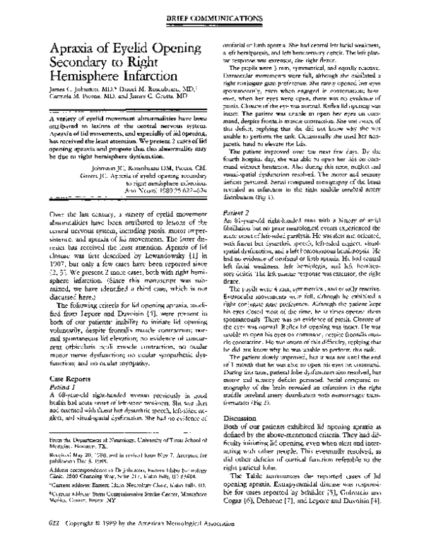Pdf Brief Communications Apraxia Of Eyelid Opening Secondary To Right