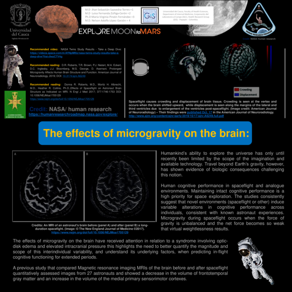 (PDF) Microgravity's Impact on Brain Health