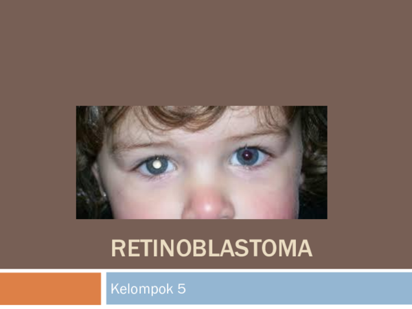 (PPT) Retinoblastoma