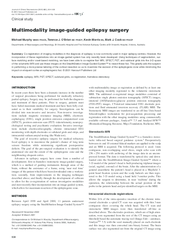 (PDF) Multimodality image-guided epilepsy surgery