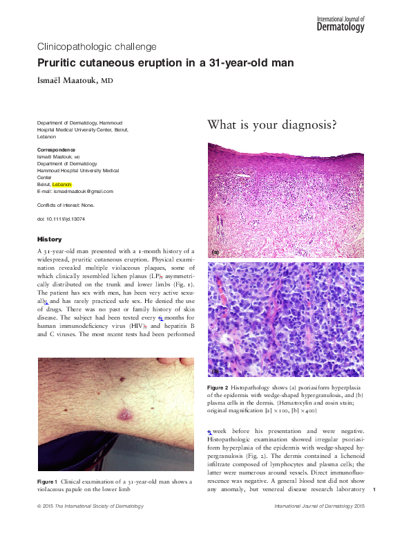(PDF) Pruritic cutaneous eruption in a 31-year-old man