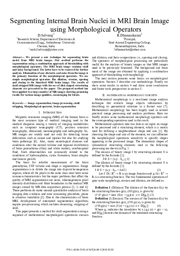 (PDF) Segmenting Internal Brain Nuclei in MRI Brain Image using Morphological Operators
