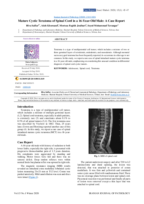 (PDF) Mature Cystic Teratoma of Spinal Cord in A 16-Year-Old Male: A ...