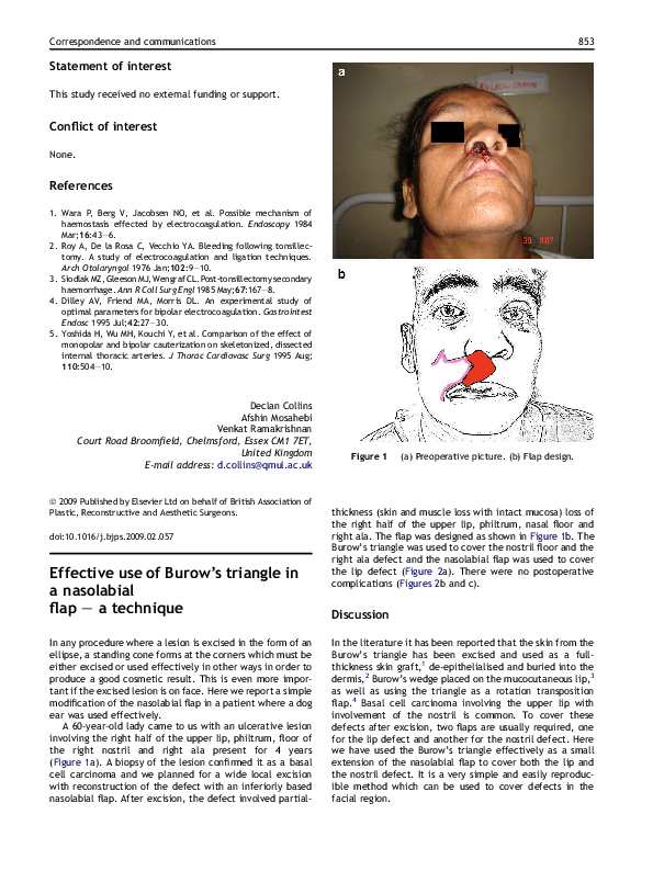 (PDF) Effective use of Burow's triangle in a nasolabial flap – a ...