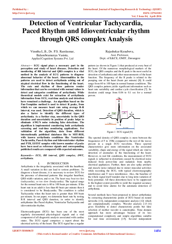 (PDF) IJERT-Detection of Ventricular Tachycardia, Paced Rhythm and ...