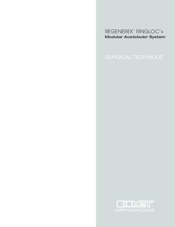 (PDF) RegeneRex ™ Ringloc ® + Modular Acetabular System