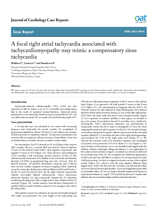 (PDF) Termination of a long RP supraventricular tachycardia by carotid ...
