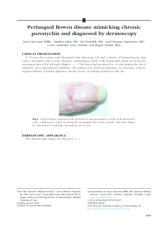 (PDF) Perianal Bowen's disease | Soledad Oliart - Academia.edu