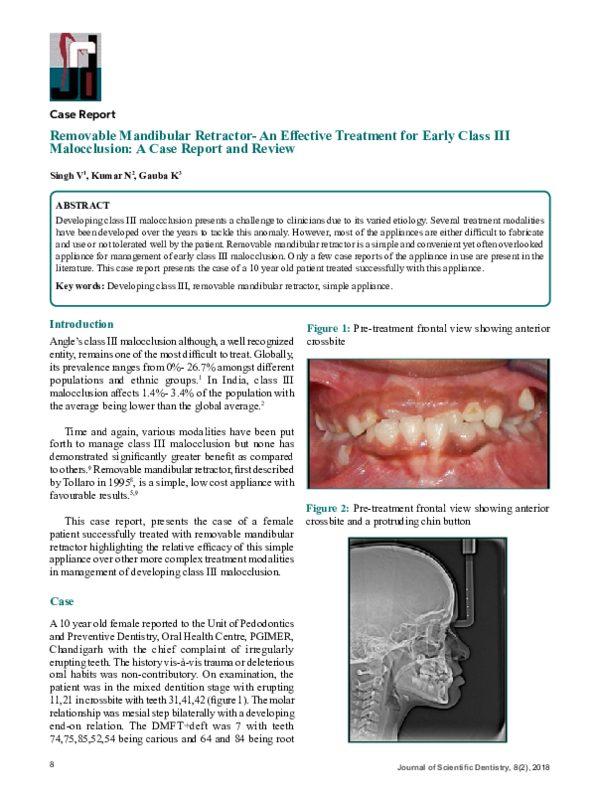 (PDF) Removable Mandibular Retractor-An Effective Treatment for Early ...
