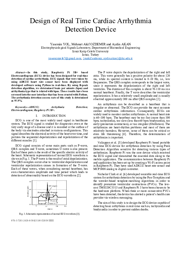 (PDF) Design of Real Time Cardiac Arrhythmia Detection Device