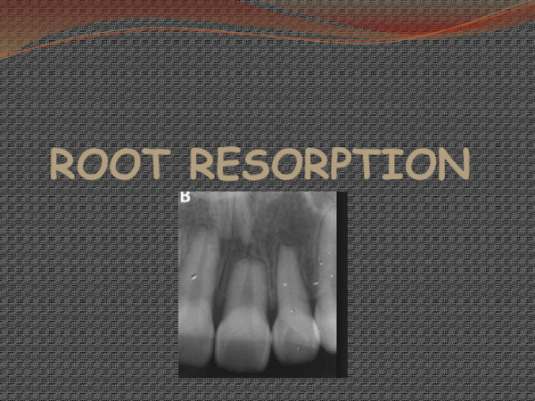 (PPT) ROOT RESORPTION seminar