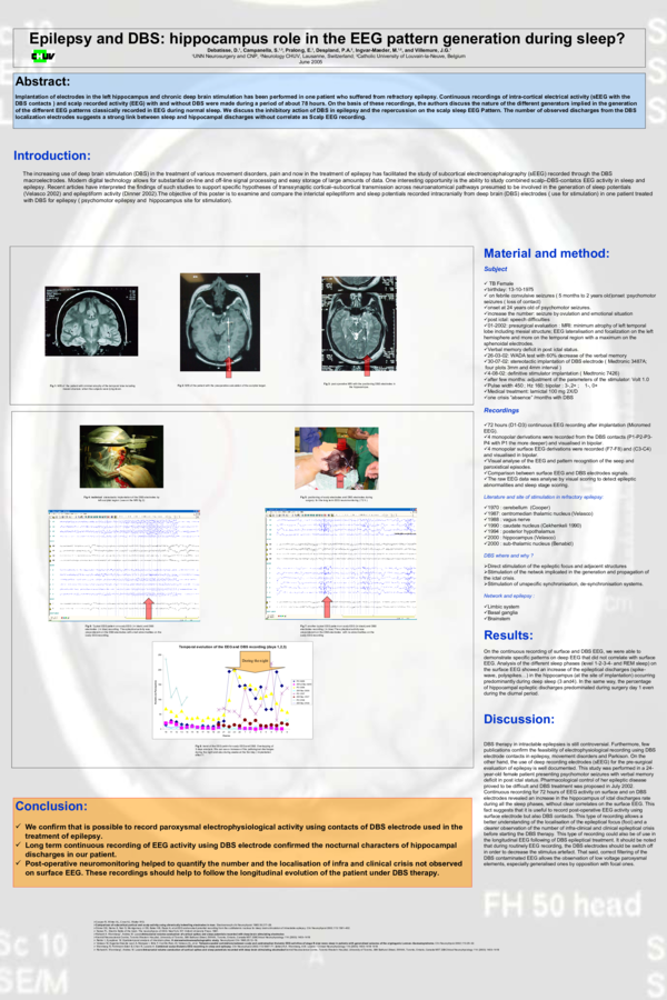 (PDF) Epilepsy and DBS: hippocampus role in the EEG pattern generation ...
