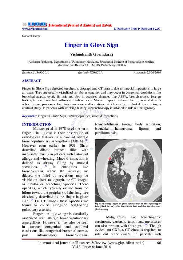 (PDF) Clinical Image Finger in Glove Sign