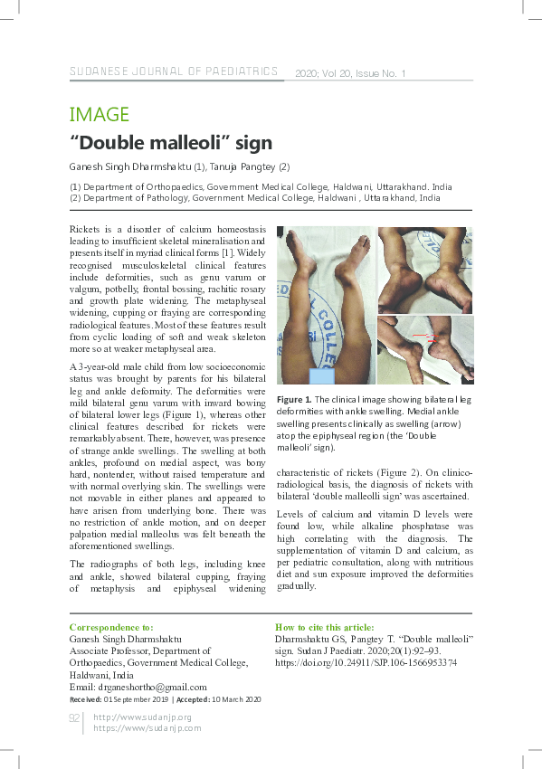 (PDF) IMAGE "Double malleoli" sign